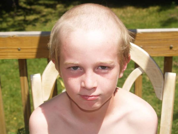Brave Child Shaves Head in Solidarity With Balding Father – WordBrothel