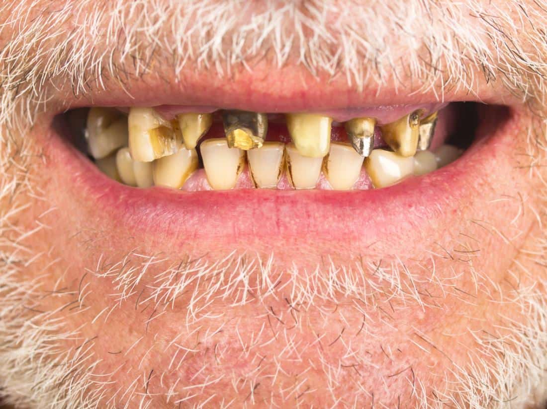 scurvy-teeth – WordBrothel